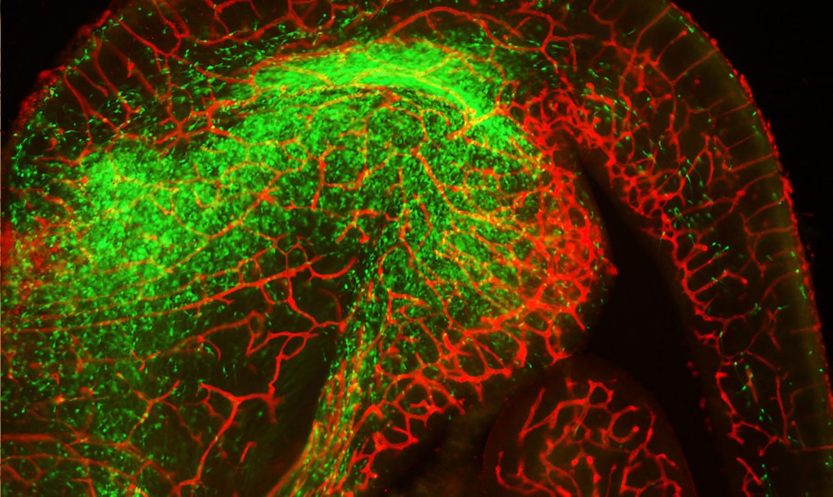 The Angiogenesis and Brain Development Laboratory – Anju Vasudevan, PhD